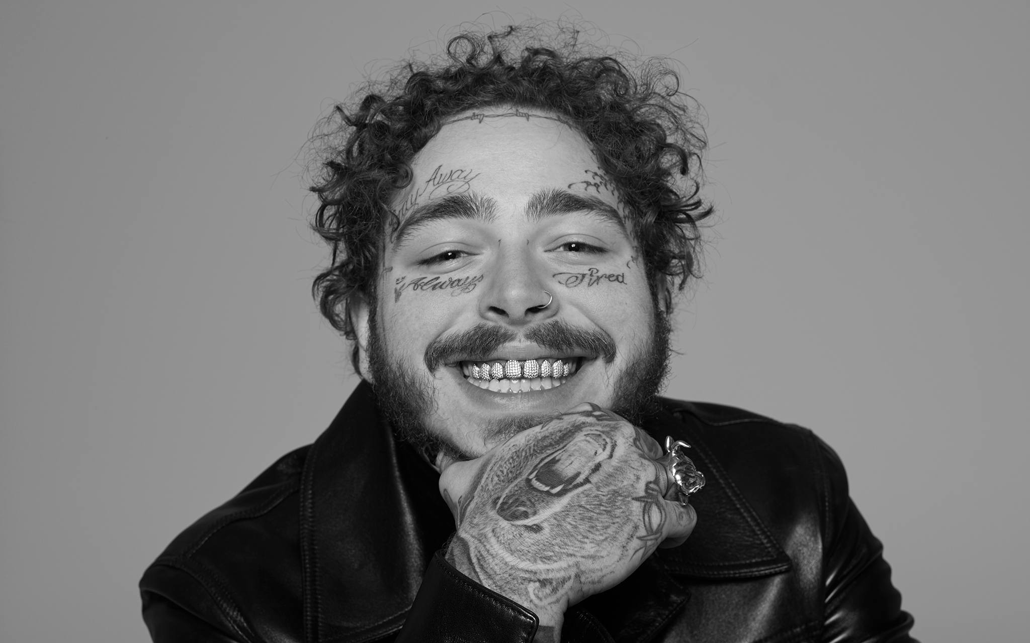 Post Malone Teeth 2025 | Million Dollar Smiles